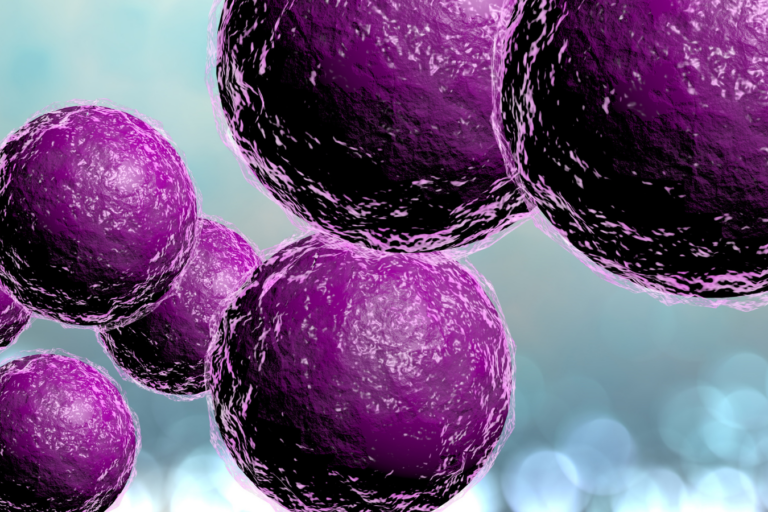 All About Prosthetic Joint Infections | Advanced Ortho and Spine