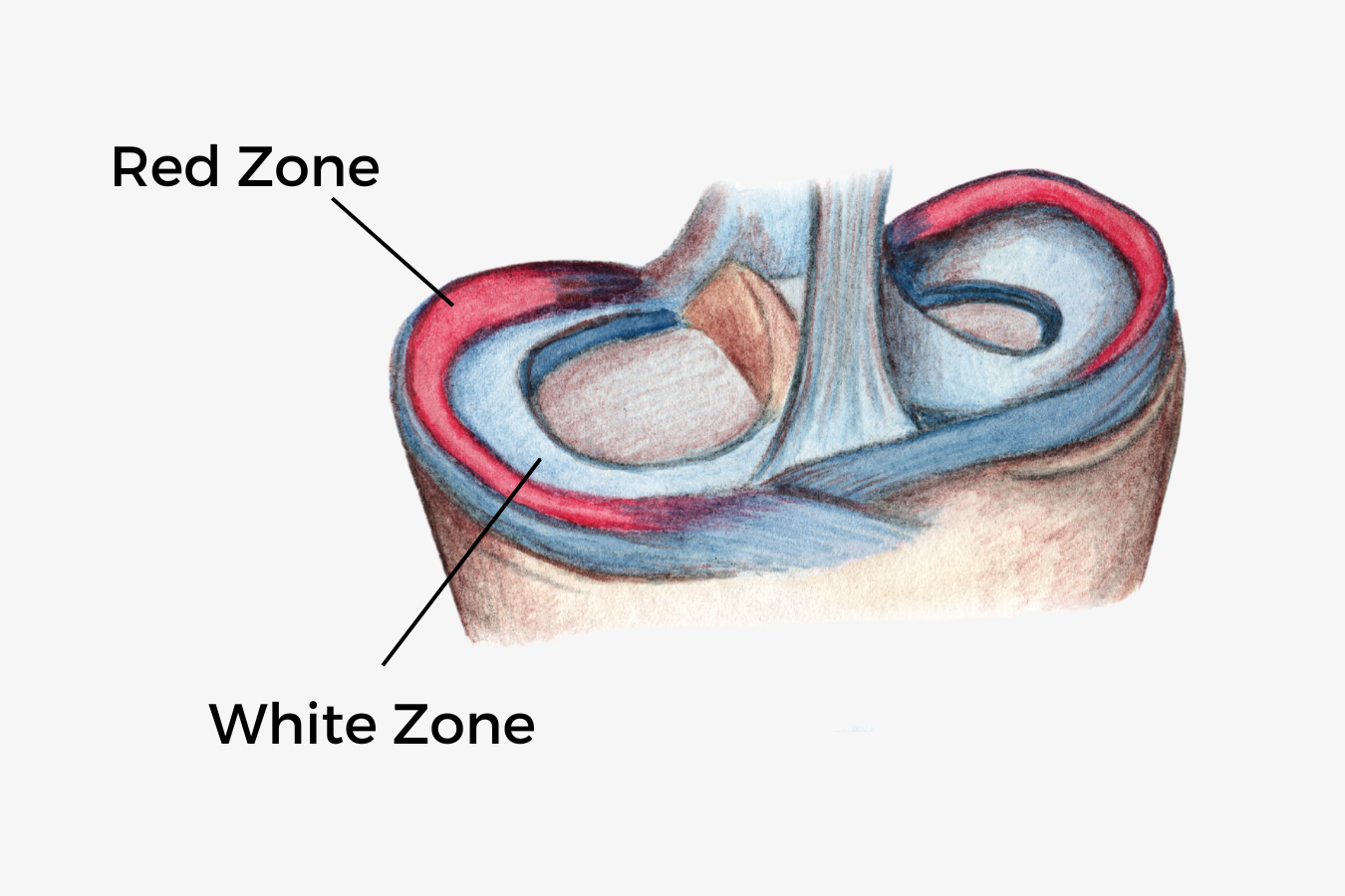 All About Meniscus Tears | Advanced Ortho and Spine
